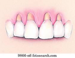 Primary Teeth Unlabeled Stock Illustration | 9931c_hr | Fotosearch