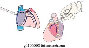 Heart anatomy Stock Illustration | ccp01049 | Fotosearch