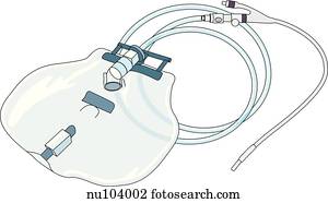 Urinary catheter and bag Stock Illustration | aa01064 | Fotosearch