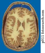 Outline of the head and neck. Drawing | sa101033 | Fotosearch