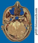 Outline of the head and neck. Drawing | sa101033 | Fotosearch