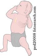 Drawing of child showing symptoms of respiratory distress. Drawing ...