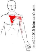 Sternocleidomastoid m., trigger points Clip Art | mm106011 | Fotosearch